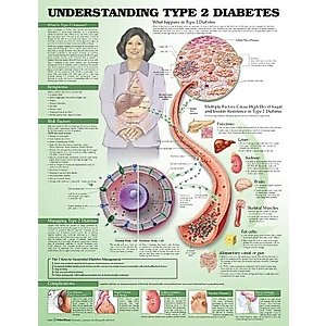 Understanding Type 2 Diabetes Anatomical Chart
