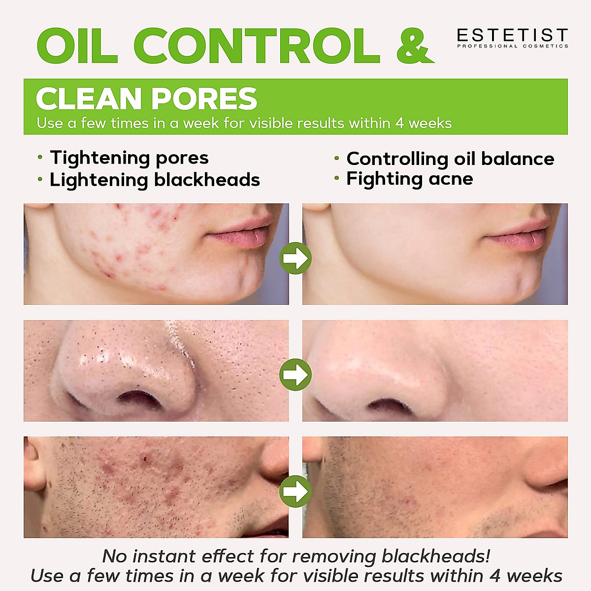 ESTETIST Green Tea Clay Mask Stick Set Purifying Face Mask Replenishing Moisture Deep Pore Cleanser Blackhead Remover Oil Control Skin Detoxifying Anti-Acne Treatment for All Skin Types Pack of 3