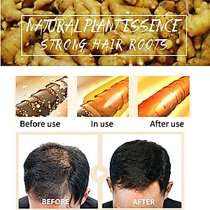 MAITING Natural Organic Ginger Hair Regrowth Shampoo Bar for Hair Growth and All Hair Types, Unisex Adult 2 Pcs