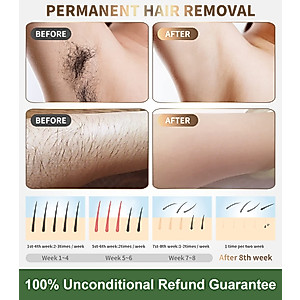 IPL Laser Permanent Hair Removal Device for Women and Men, Painless Best Hair Remover Whole Body Facial Armpits Back Legs Arms Face Bikini Line, 999,999 Flashes, Corded at-Home