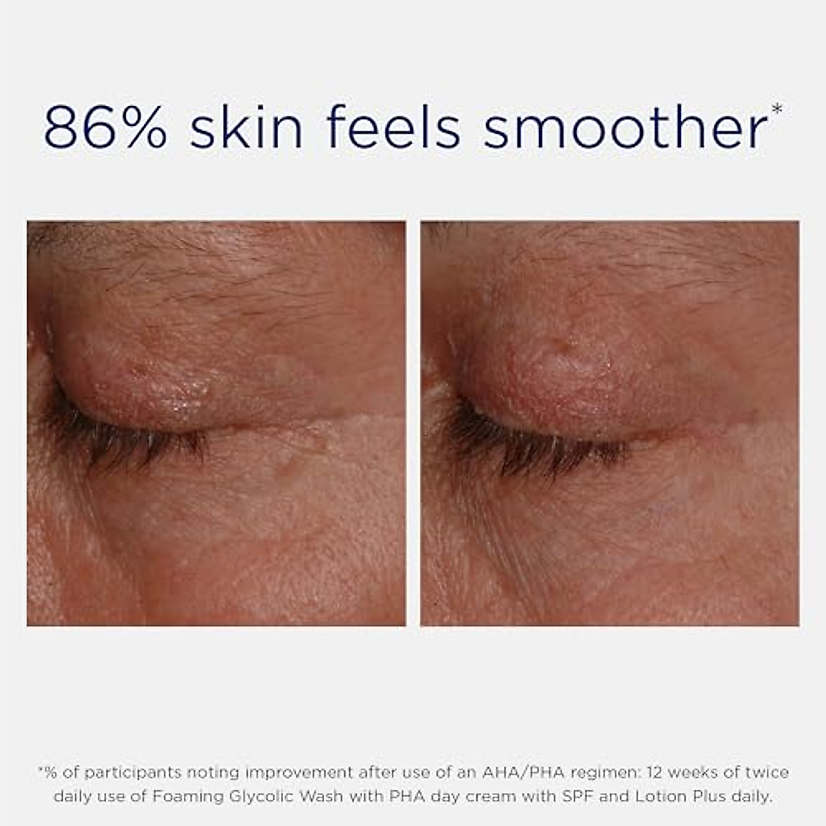 NEOSTRATA Foaming Glycolic Face Wash High Strength AHA Cleanser Soap-free, 4.2 fl. oz.