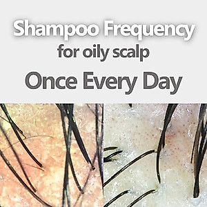 Aromase Oily Balancing Shampoo (Ideal for oily scalp with dandruff) 14 FL OZ