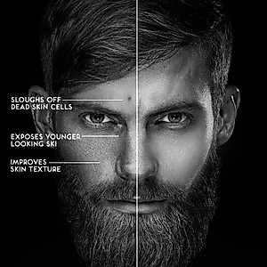 O NATURALS 3 Pack Activated Charcoal Soap Black Bar Soap with Peppermint Oil Detoxifying Body Wash Soap Bar & Face Soap Vegan Men Soap with Shea Butter 100% Natural Soap for Men & Women Soap Bar, 4oz