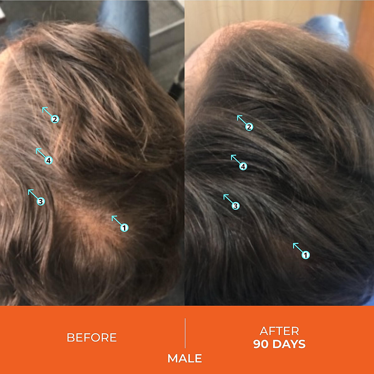 Revita Shampoo For Thinning Hair by DS Laboratories - Volumizing, Thickening Shampoo for Men and Women, Supports Hair Growth, Hair Strengthening, Sulfate Free, 7 Fl Oz (205mL) - Packaging May Vary