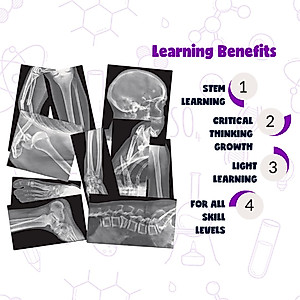 Roylco Broken Bones X-Rays – 15 Realistic Fracture Images for STEM/STEAM Learning, Classroom Anatomy, Health Education, and Labs – Perfect for Teachers, Parents, and Medical Training