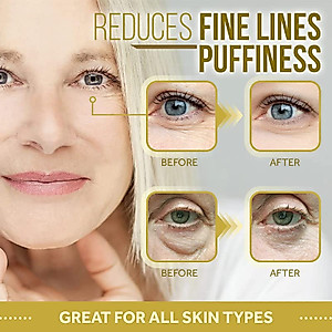 Under Eye and Forehead Patches - 26 PCS 24K Gold - Collagen and Hyaluronic Acid Pads that Helps Reducing Under Eye Puffiness, Wrinkles, and Dark Circles - NO Artificial Fragrance or Alcohol