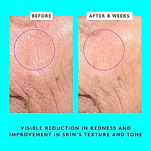 Drunk Elephant Bouncy Brightfacial Leave-On Face Mask with Azelaic Acid and Salicylic Acid to Correct and Clarify Skin (50mL / 1.69 Fl Oz)