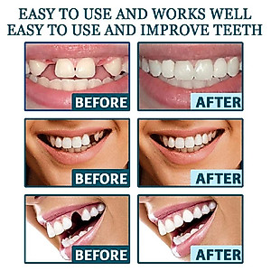 Renyqatt 2PCS Fake Teeth Adjustable Veneers Dentures Teeth for Women and Men Temporary Teeth Perfect Cover The Imperfect Teeth Nature and Comfortable (A)