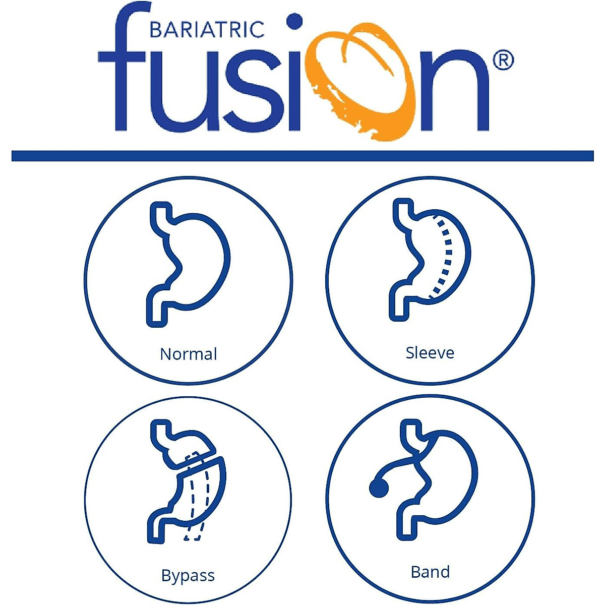 Bariatric Fusion One Per Day Bariatric Multivitamin with Iron for Women | with Hair and Nails Vitamins Blend | Gastric Bypass and Sleeve Gastrectomy | Glutren Free | 30 Capsules | 1 Month Supply