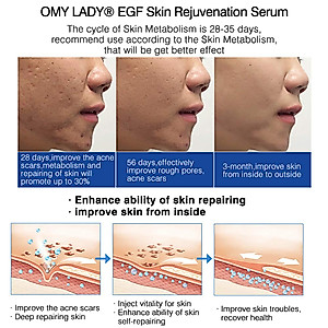 EGF Skin Rejuvenation Serum & Epidermal Growth Factor Powder Kit, Moisturizing Removing Wrinkles, Fine Lines and Pigmentation, Acne Scars Treatment Facial Repairing Serum