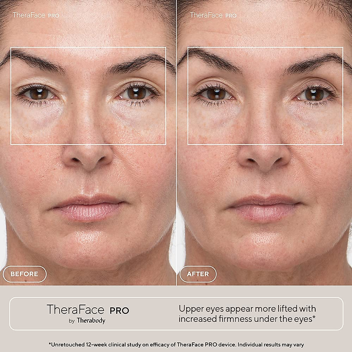 TheraFace PRO Microcurrent Facial Device - 8-in-1 Compact Face Massager, Facial Kit & Face Sculpting Tool with Light Therapy for Skin Tightening, Anti Wrinkle, Anti Aging & Skin Care (White)