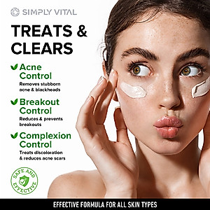 Acne Medication Face Cream - Made in USA Fast Acting Drug Acne Treatment For Stubborn Pimple Blackhead Whitehead Blemish - Soothing Acne Moisturizer for Inflammation Relief & Acne Scar Prevention 2oz