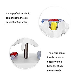 YUYTE Human Spine Model, Human Anatomical Lumbar Disc Herniation Model Human Spine School Training Supplies Excellent Way for Demonstrating Disc, Restore The Details of The Human Spine