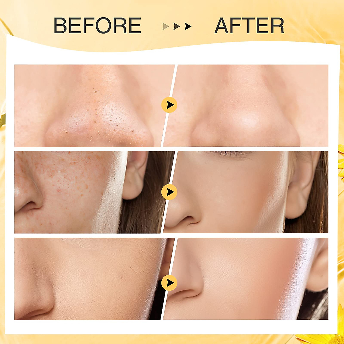 Turmeric Clay Stick Mask Organic Vitamin C Purifying Mask for Blackhead Cleansing Healing Clay Mud Mask for Deep Clean Pore Improve Skin Acne Scars Facial Mask With Blackhead Remover Extractor Tools