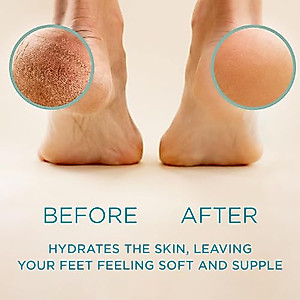 Lee Beauty Professional Callus Remover for Feet - Original, Powerful Formulation - Extra Strength Gel, Home Pedicure Foot Spa Results - Cracked & Dead Dry Skin Supplies - 8 Oz