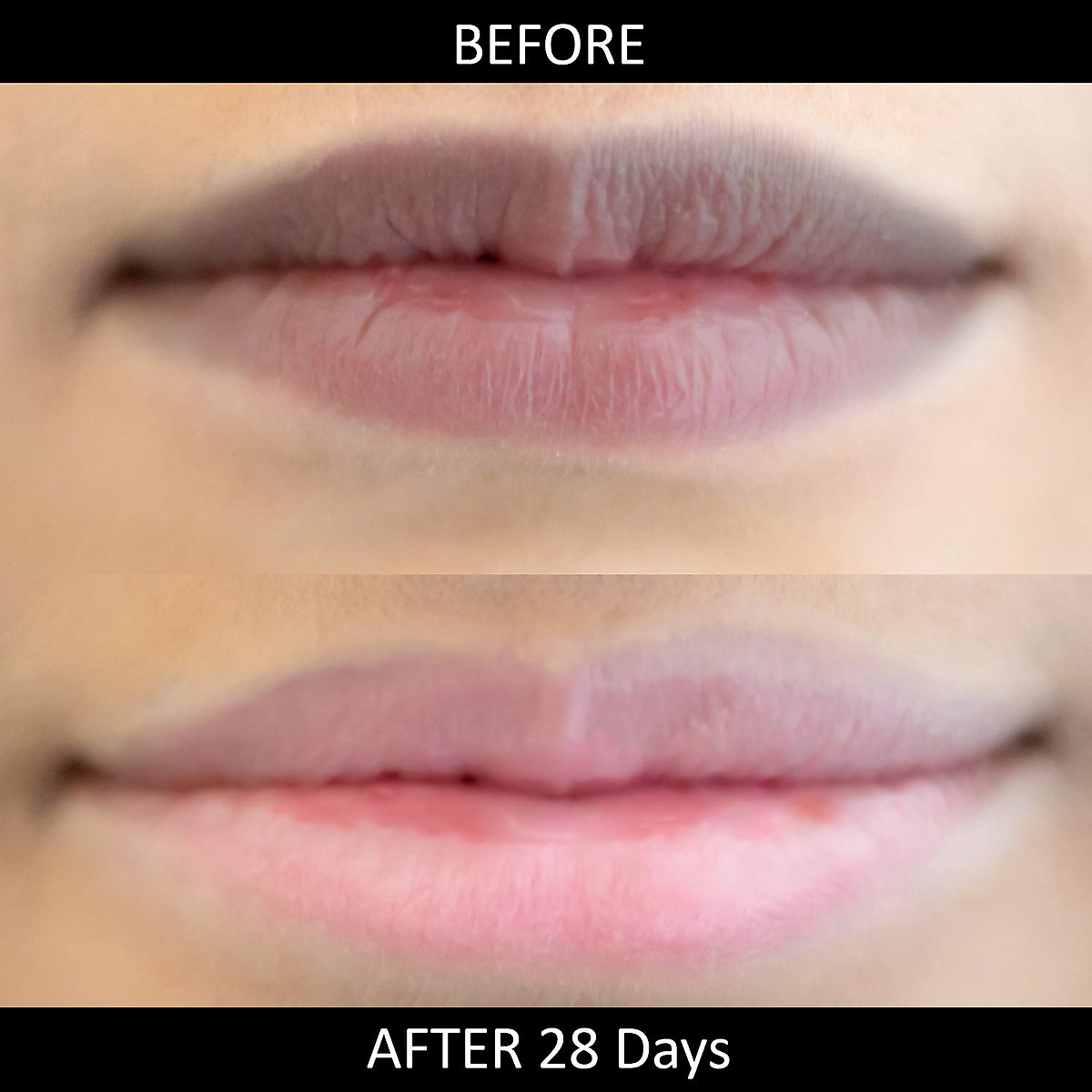 Omorfee 100% Organic Lip Lightening Balm, balm for Dark Lips, Balm with SPF, Natural Protection, Repair, Moisturizer, Cocoa Butter, Carrot Seed Oil & Pineapple Extract -10g/ 0.35Oz