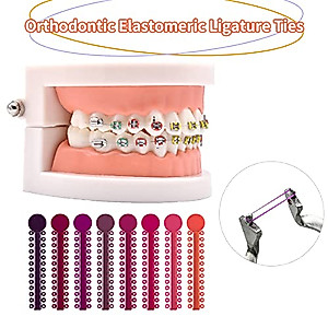 1040 Pcs Multicolored Braces Rubber Bands Orthodontic Ligature Ties O-Rings Elastic Bands for Braces (Color)