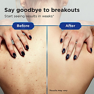 Non-Comedogenic Hair Conditioner for Blemish Free Skin by Clear 2 Perfection with Fresh Cells Strawberry and Kiwi Suspensions. Hair Conditioner for Acne. Made in USA