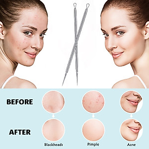 Titanium Lancet Needle Pimple Popper Tool Facial Milia Remover Blackhead Blemish Remover Blackhead Whitehead Extractor Professional Lancet Zit Blemish Comedone Removal Tool 2 Pieces with Box