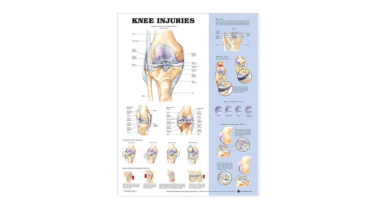 Knee Injuries Anatomical Chart | Detailed Knee Anatomy & Injuries