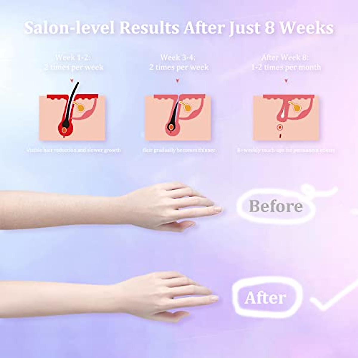 Laser Hair Removal for Women and Men, Permanent Ipl Hair Removal Device with 999,900 Flashes,9 Energy Levels Hair Removal Tool for Facial Legs Arms Whole Body(White)