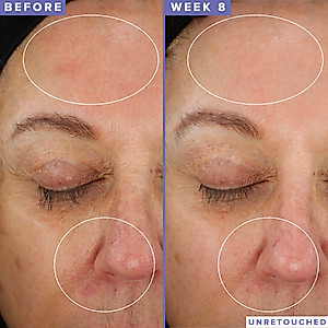 Farmacy Niacinamide Overnight Face Mask - Pore Refining Facial Mask with 10% Niacinamide - Replenishes Moisture Barrier with 3% Panthenol + Blueberry Seed Oil for Soft, Supple Skin (50ml)