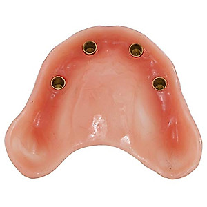 DENTALMALL Dental Upper Implants Model Overdenture with 4 Superior Teeth Demo Transparent Vision for Education and Study Model Tool M6001 C