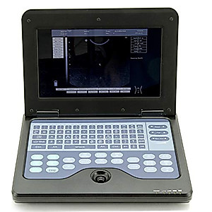 CONTEC Vet/Veterinary/Animal Portable B-Ultrasound Scanner with Tow Probes Convex and Rectal Probe for Cattle,Horse,Camel,Equine,Goat,Cow,Sheep and Pig