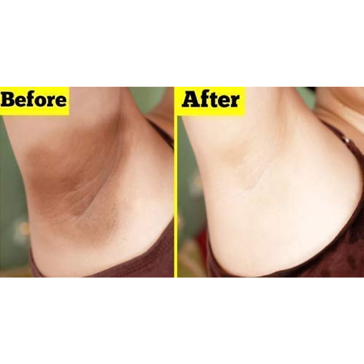 20 Pcs Crema Aclaradora Para Piel Manchas En Cara Axilas Cuello Entrepierna - (1.77FL.Oz x 20 Pcs)