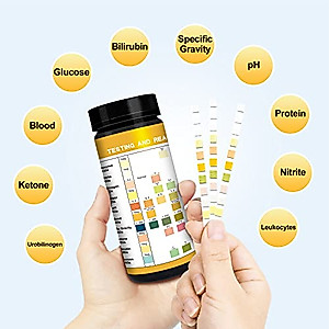 Easy@Home Dog Diabetes Urine Test: 10 Parameters Urine Test Strips for Dogs & Cats Animal Urinalysis Reagent Strips - Detect Urinary Tract Infections UTI Bladder Kidney Liver Function 100 Counts