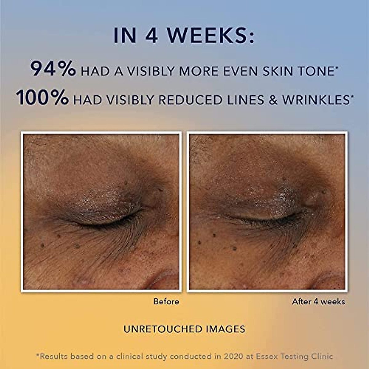 RoC Multi Correxion Revive + Glow 10% Active Vitamin C Serum for Face, Daily Anti-Aging Wrinkle and Skin Tone Skin Care Treatment, Brightening Serum for Dark Spots, 1 Fluid Ounce