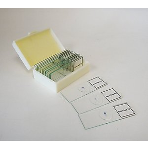 Prepared Slide, Plant Mitosis, Classpack of 15 Sides