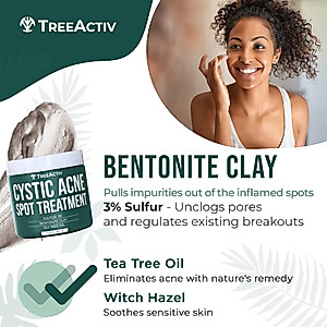 TreeActiv Cystic Acne Spot Treatment, 2-Pack, Sulfur Spot Treatment, Hormonal Acne Treatment with Tea Tree, Cystic Acne, Blackheads, Cystic Acne Treatment and Pimple Spot Treatment for Face, 240+ Uses