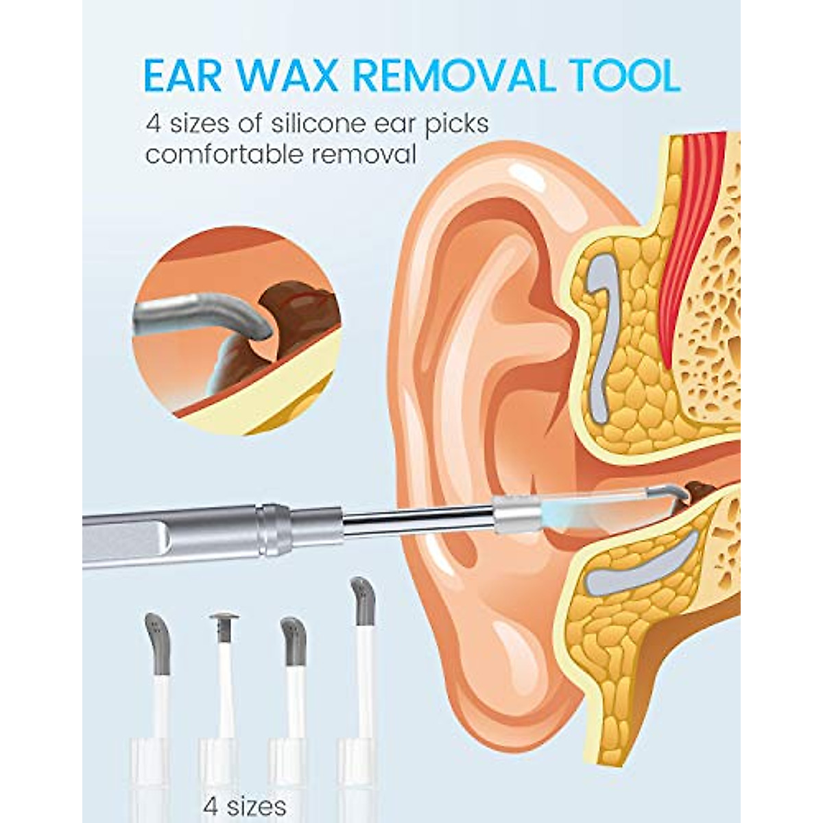 Teslong Otoscope Set with Disposable Covers, Ear Pick, 4.3mm HD Inspection Camera, 6 Adjustable LED Lights with Ear Wax Removal Tools, Works with iPhone, iPad & Android