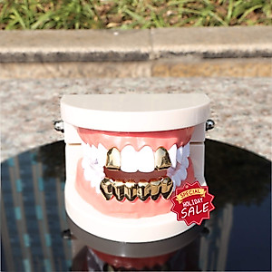 Gold Grillz Mouth Teeth 24K Plated Gold Custom Fit Top & Bottom Set Caps Grillz For Women Gift + Extra Molding Bars + Microfiber Cloth