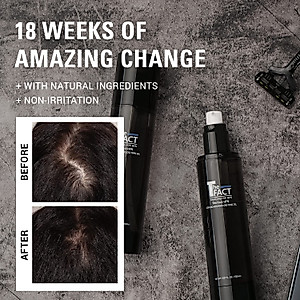 The Fact Men’s Scalp Soothing and Cooling Hair Serum - Calm & Soothe Itchy Scalp - Cooling Tonic Gel - The Fact HFN Cooling Scalp Relief Tonic Gel 5.07 Ounce
