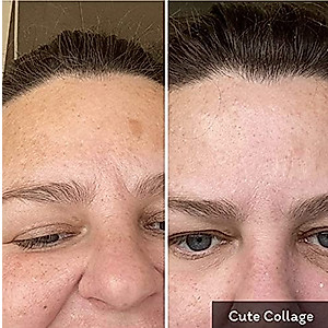 Dark Spot Corrector, Dark Spot Remover for Face, Melasma and Hyperpigmentation Treatment, Dark Spot Serum, Age Spot Remover, with Tyrostat, Kojic Acid, Alpha Arbutin, Mulberry Extract, Lactic Acid 1oz