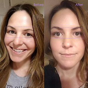 Invisible Lace Self-adhensive Fiber One-Sided Sticky Double Eyelid Tapes Stickers, Medical-use Breathable Fiber Instantly Eyelids Lift, Suitable for Hooded, Droopy, Uneven, Mono-eyelids