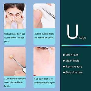 Best Acne Removal, Blackhead Remover, Pimple Comedone Extractor, Blemish Whitehead Removing, Popping Zit Tool, Popper Kit, for Nose Face