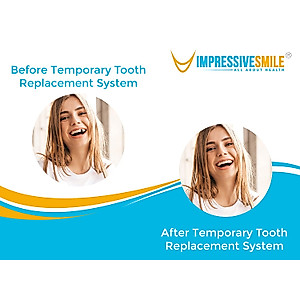 Impressive Smile Patient Trusted Temporary Tooth Replacement System