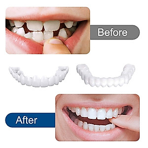 Tooth Repair, Cover The Imperfect Teeth,Fix Your Smile at Home Within Minutes!,Upper and Lower Whitening Teeth Sets2pcs