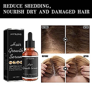 Allurium Hair Growth Serum for Black Women, Anti Hair Loss Nourish Dry Damaged Hair Repair, New Allurium Hair Growth Serum, Fast Natural Hair Growt, Allurium Beauty Hair Serum for Black Women (1PC)