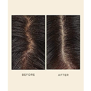 VEGAMOUR GRO Scalp Detoxifying Serum, 2 FL Ounce