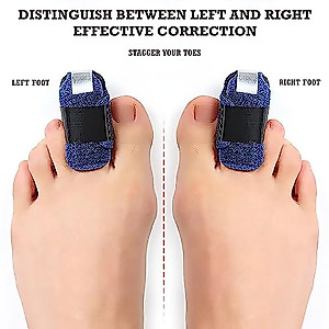 2 Pack Toe Splint,Toe Straightener for Hammer Toe, Bent Toe, Claw Toe, Crooked Toe, Curled Toe, Toe Brace, Broken Toe Splint, Hammer Toe Corrector, Toe Wrap to Align and Support Toe (Blue)