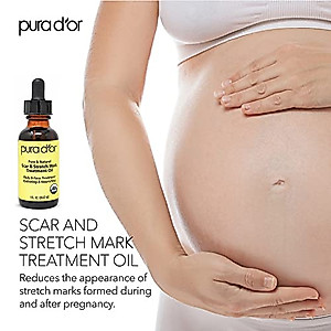 PURA D'OR Organic Scar & Stretch Mark Treatment Oil (1oz) For Skin - With Rosehip, Wheat Germ, Argan, Tamanu, Carrot, Rosemary, Lavender, Geranium, Patchouli, Sage
