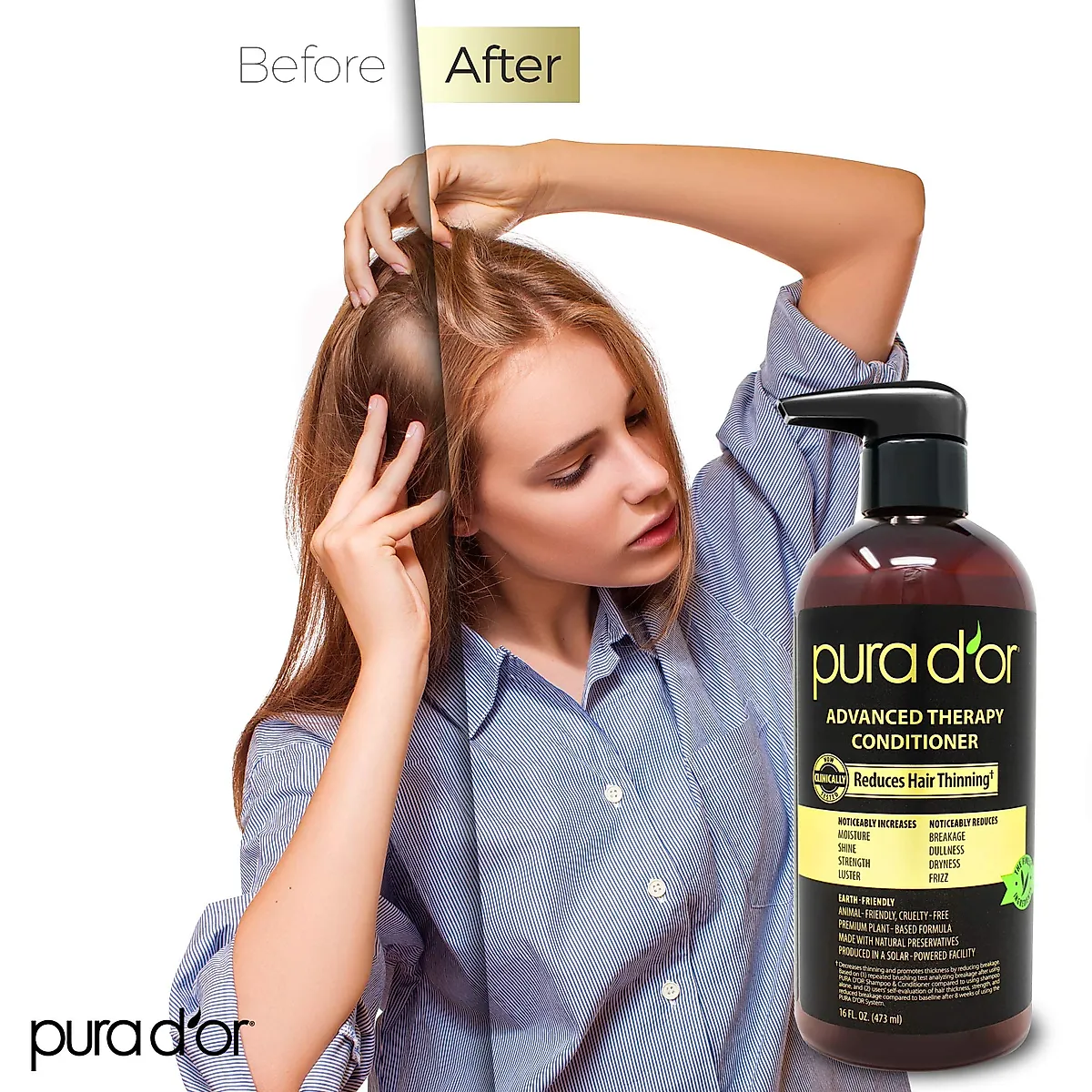 PURA D'OR Advanced Therapy Conditioner (16oz) For Increased Moisture, Strength, Volume & Texture, No Sulfates, Contains Argan Oil & Biotin, All Hair Types, Men & Women (Packaging May Vary)