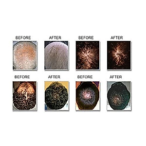 Revivogen Pro Bio-Cleansing Shampoo - DHT Blocker for Hair Loss and Thinning Hair, Suitable for Women and Men's Hair Routine, 8oz