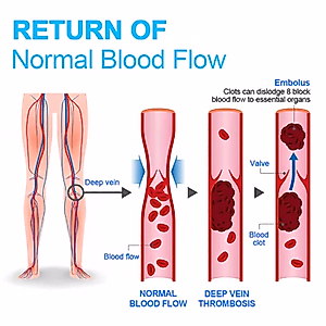 Ionic Correction Lymphatic Detoxification Long Tube Silk Stockings, Thigh Massager Socks, Compression Boots Socks (3pairs (Skin Color, Black, Brown))