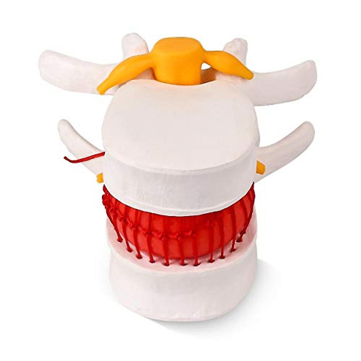 MIIRR Human Lumbar Disc Herniation Model, Vertebral Spine Anatomical Medical Model Perfect for Learning & Teaching Tool - Lumbar Vertebral Spine Model