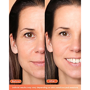 NEWKEY Red Light Therapy Mask for Face,7 Colors LED Face Mask Light Therapy, At-Home Photon Skin Care Beauty Mask for Anti Wrinkles Acne Reduction